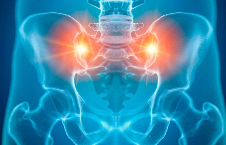 Bekken pijn, Bekkeninstabiliteit